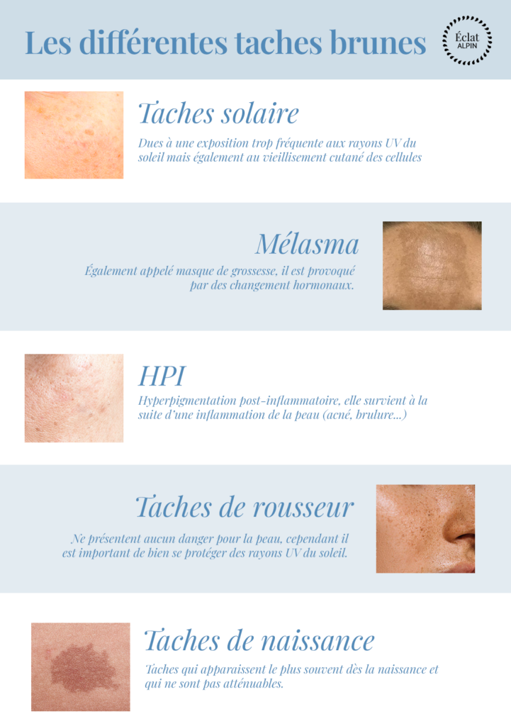 Taches brunes sur la peau - Comment les atténuer
